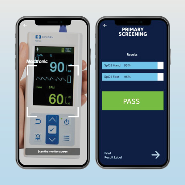 Pulse Oximetry For CCHD Screening | Medtronic