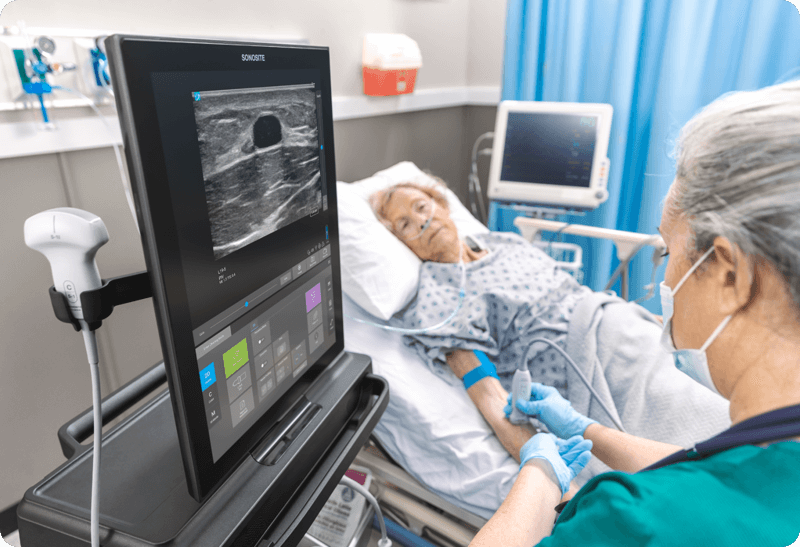 Ultrasound machines for clinicians worldwide | Sonosite