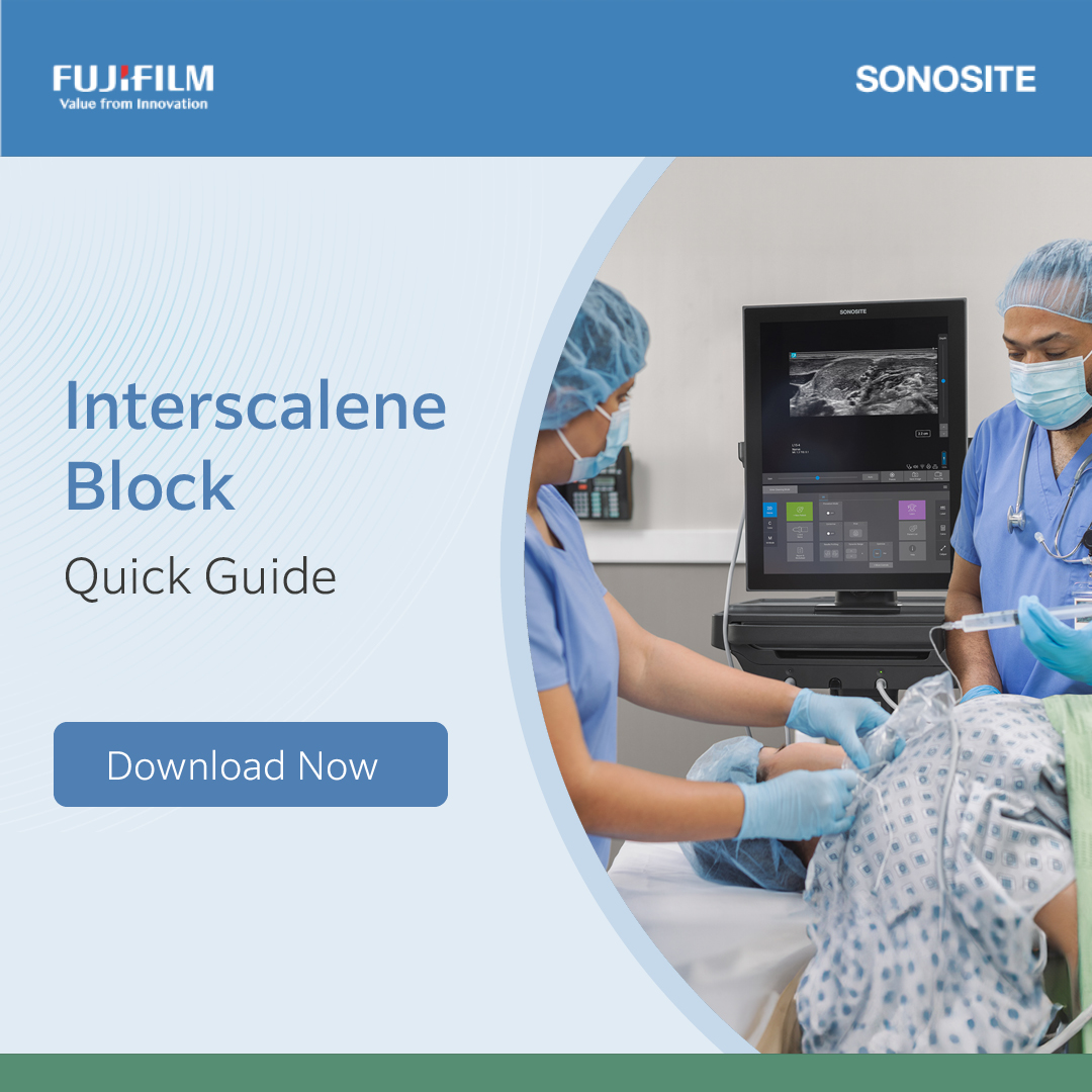 Get your Interscalene Block Quick Guide | Sonosite